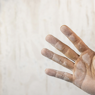 Paint Defects and Solutions